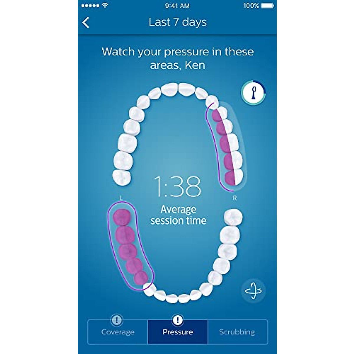 Philips Sonicare DiamondClean Smart 9500 Rechargeable Electric Power Toothbrush, Black, HX9924/11