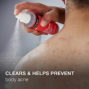 Neutrogena Stubborn Body Acne Spray With Salicylic Acid, Fragrance-Free Spray Acne Treatment to Clear & Help Prevent Acne, Ideal for Chest & Back Breakouts, 2% Salicylic Acid, 5.5 fl. oz
