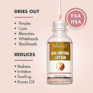 Ebanel Acne Drying Lotion, Overnight Salicylic Acid and Sulfur Cystic Acne Spot Treatment for Face and Body, Pimple Cream Spot Treatment, Dries Out Pimples, Cysts, Blemishes, Zits, and Clogged Pores