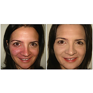 Judith August Killer Cover - Light/Medium - Cover Bruises, Tattoos, Age Spots, Vitiligo & More