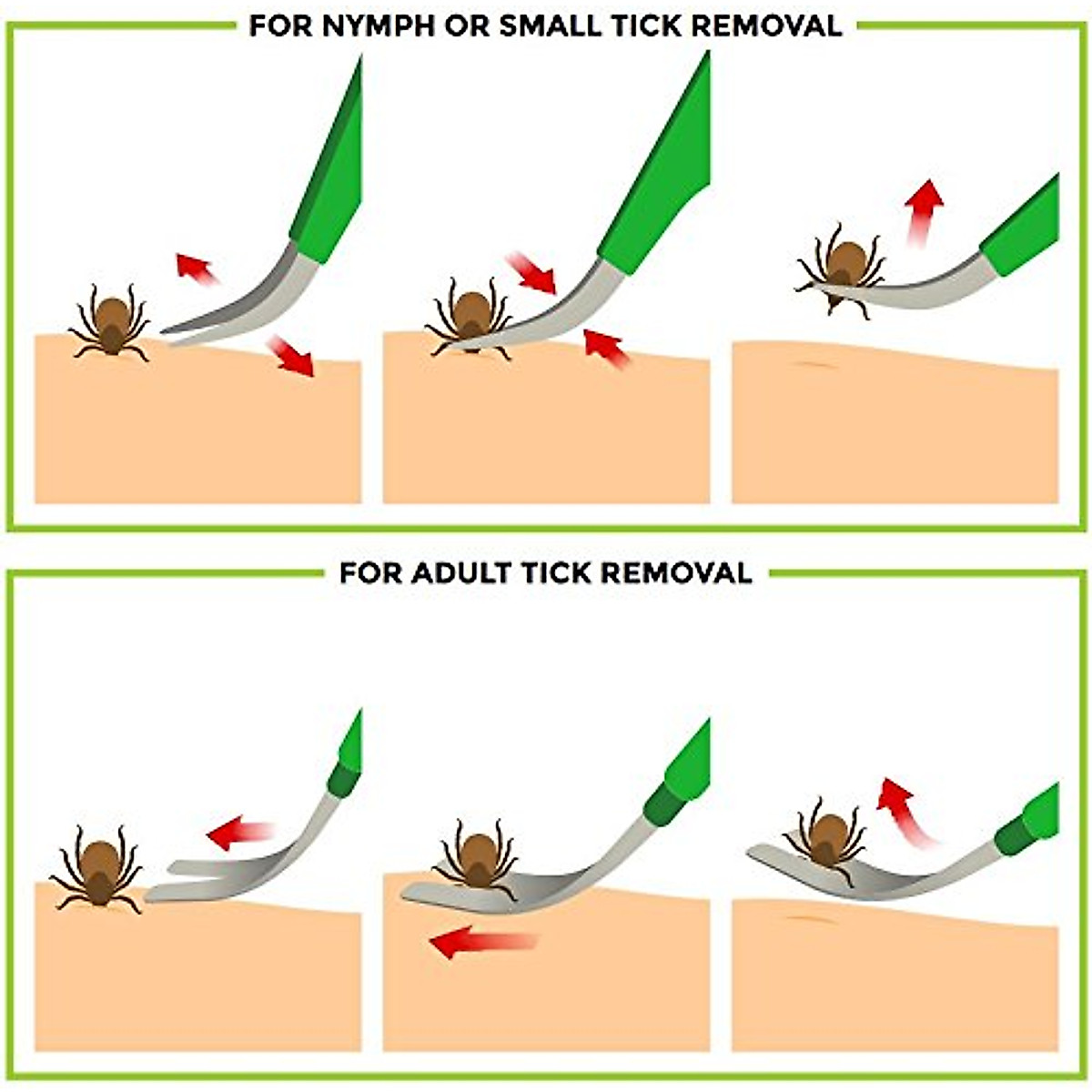 TickCheck Premium Tick Remover Kit - Stainless Steel Tick Remover + Tweezers, Leather Case, and Free Pocket Tick Identification Card (1 Set)