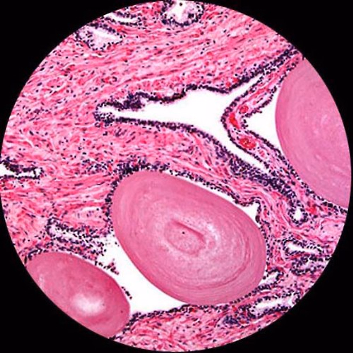 AmScope 40X-1000X LED Student Microscope + 5MP USB Camera (M150C-E5)