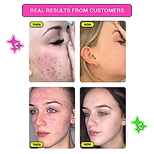 Carbon Theory | Charcoal & Tea Tree Oil Facial Cleansing Bar in Resealable Travel Pack | 100g