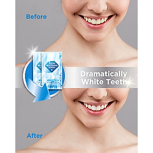 Teeth Whitening Strips for Sensitive Teeth, Reduced White Whitening, Enamel Safe Strips, 28 Pcs Natural Whitener 14 Treatments by Imosty