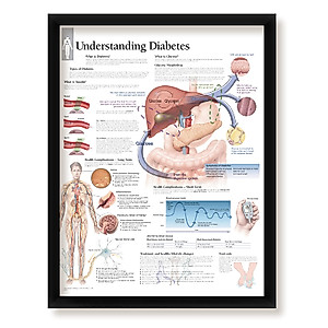Set of 4 Framed Medical Posters Understanding Diabetes Understanding Cholesterol Understanding Metabolic Syndrome and Understanding Hepatitis 22"x28" Wall Diagrams