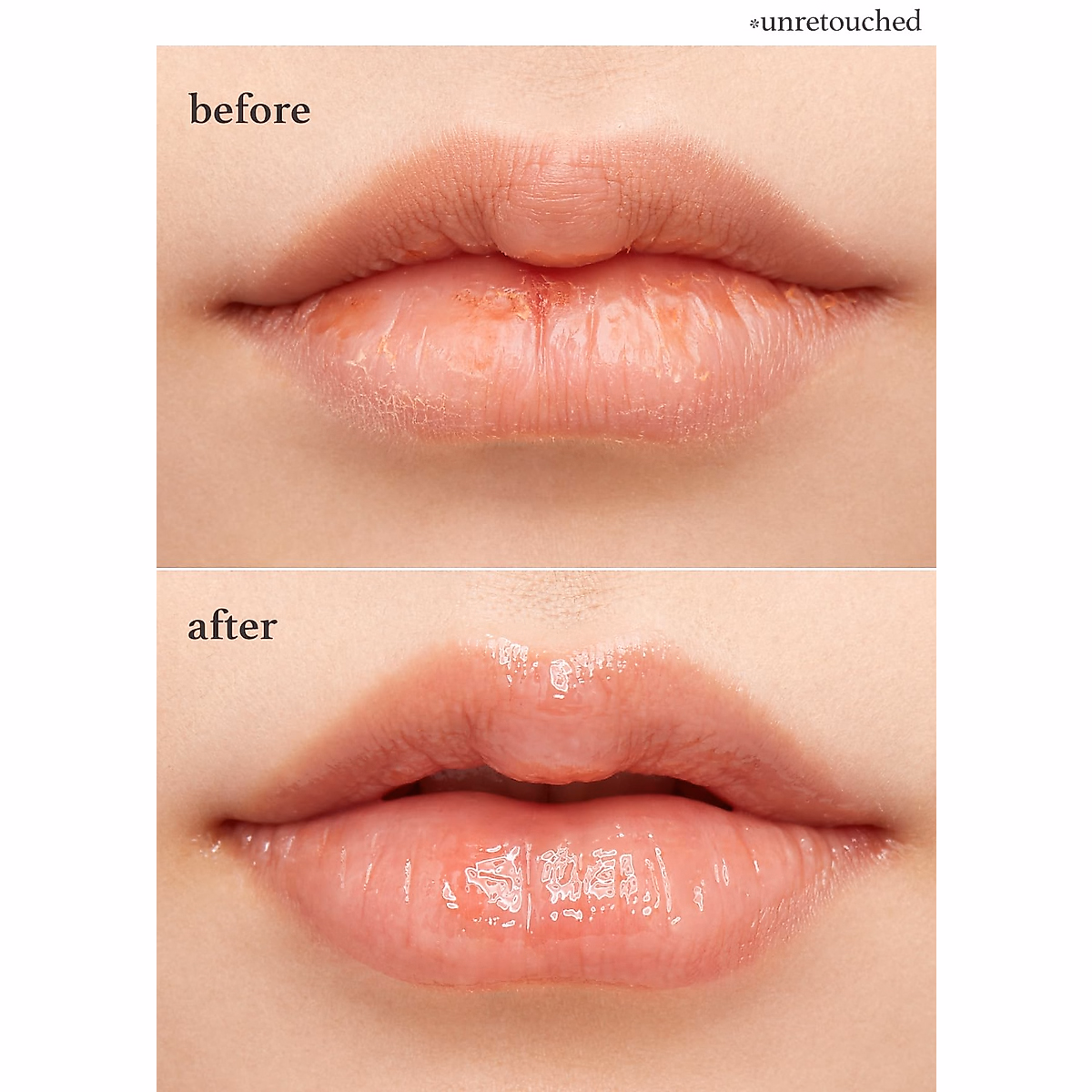 NOONI Korean Lip Butter Overnight Melting Balm (Applebutter) Lip Mask, with Shea Butter and Vitamins | Hydrating, Nourishing, Lip Balm, Soothing, Moisturizing, Softening, Korean Skincare