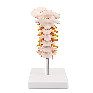 Ultrassist Cervical Spine Model with Cervical Vertebrae, Cervical Nerves, Vertebral Arteries & Occipital Plate for Medical Education