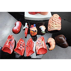11 Inch Human Torso Anatomy Model Anatomical Organ Structure Model,15 Detachable Aparts Excellent Mediacal Teaching Supplies and Leaning Tools