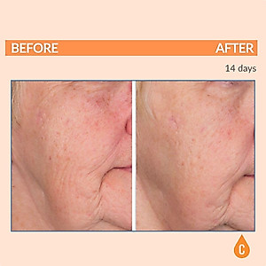 Serious Skincare - C3 Vitamin C Ester Protective Daytime Broad Spectrum SPF 30 Moisturizer - 2 oz. - Facial Cream - Sunscreen - Hydrating - Smoother Skin 2 oz.