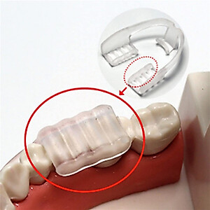 Ellylian Bite Guard for Teeth Clenching Nighttime Mouth Guard Kids Sleep Teeth Guards for Upper and Lower Jaw Night Grinding Teeth Guard Comfortable Transparent Dental Guards