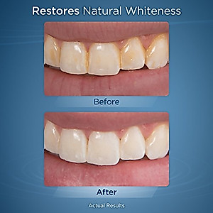 Waterpik Whitening Water Flosser, White (WF 05) Electric Oral Irrigator Flosser Whitens Teeth Gently