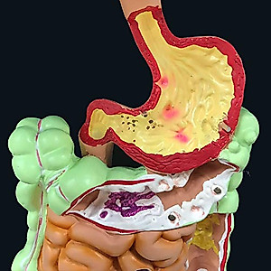 Human Digestive System Stomach Anatomy Model The Large Intestine Cecum Rectum Duodenum Anatomy Model Medical Teaching Supplies