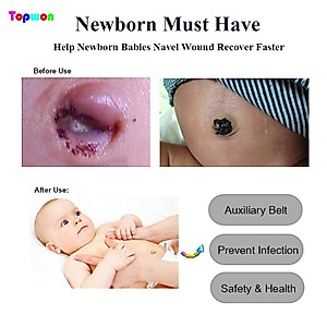 Topwon 10 Pcs Baby Belly Band Newborn Belly Binder Infant Umbilical Cord Band Belly Button Warp Registry Must Haves Gift Cotton