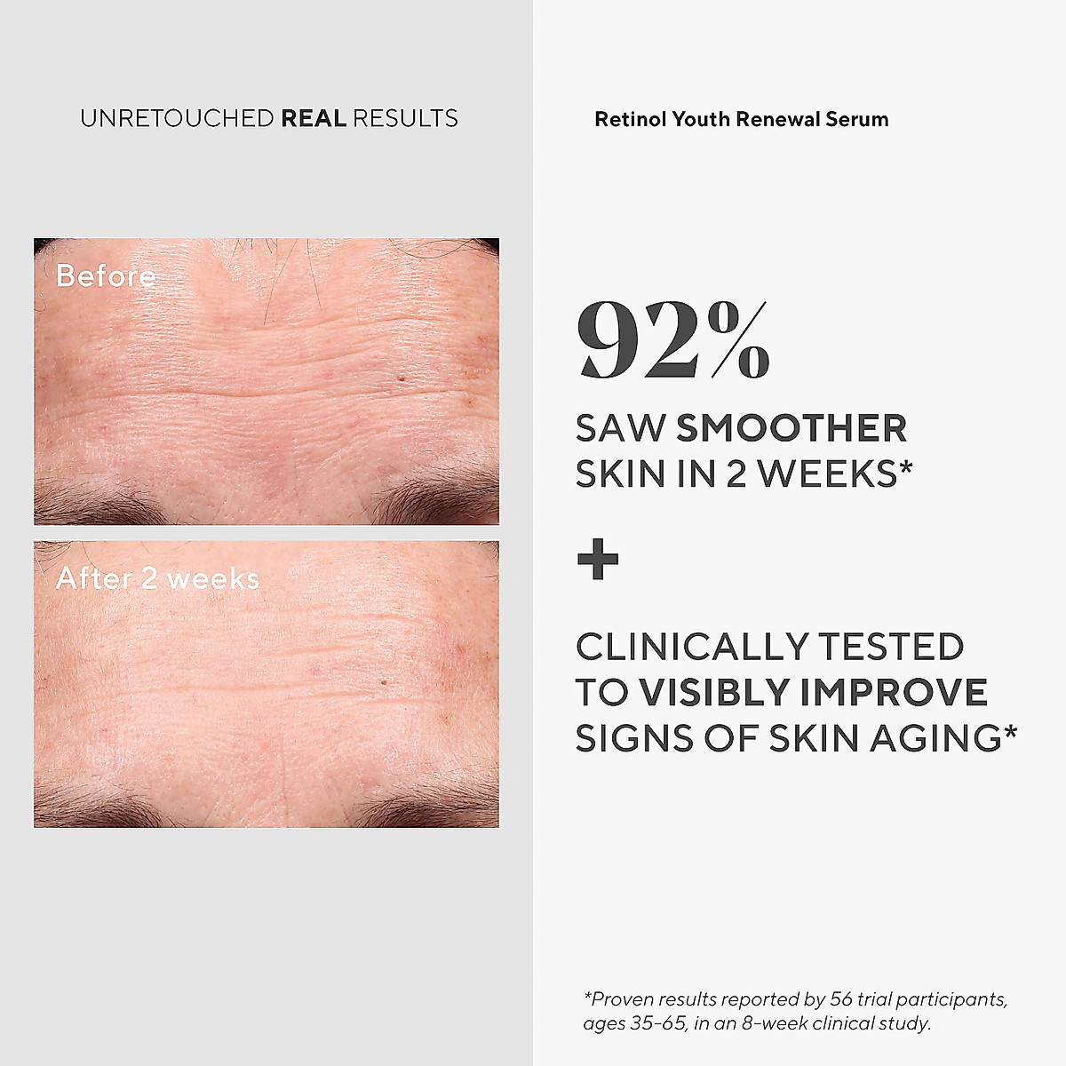 Murad Youth Renewal Retinol Trial Kit – 3-Piece Trial-Size Kit $102 Value - Anti-Aging Retinol Skincare Set - Retinol Serum for Face, Retinol Eye Serum, & Retinol Night Cream