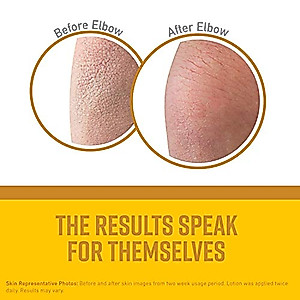 O'Keeffe's Skin Repair Body Lotion and Dry Skin Moisturizer, Pump Bottle, 12 ounce, Packaging May Vary