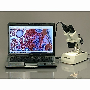AmScope SE305R-PZ-LED Forward-Mounted Binocular Stereo Microscope, WF10x and WF20x Eyepieces, 10X/20X/30X/60X Magnification, 1X and 3X Objectives, Upper and Lower LED Lighting, Reversible Black/White Stage Plate, Pillar Stand, 120V or Battery-Powered