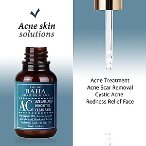 Azelaic Acid + Tea Tree Clear Skin Facial Serum with Niacinamide 10%, Salicylic Acid, Retinol - Fast & Efficient Cystic Acne, Age-Defying, Relieve Trouble Skin Formula, 1 Fl Oz (30ml)