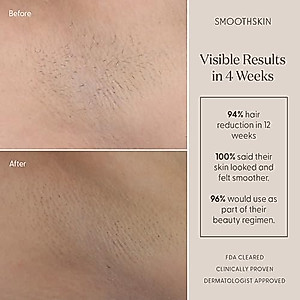 SmoothSkin Pure Mini IPL Laser Hair Removal Device, Long-Lasting, for Body & Facial Hair Removal, Alternative to Laser Hair Removal, Bikini Shaver & Epilator, with Precision Head for Small Areas