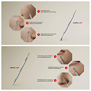 Suvorna Skinpal Pimple Popper Tool Kit | Milia Remover | Lancets for Facial Extraction | Whitehead Extractor Tool | Comedone Extractor | Blackhead Remover Tool | Acne Needle Tool & Cyst Removal Tool.