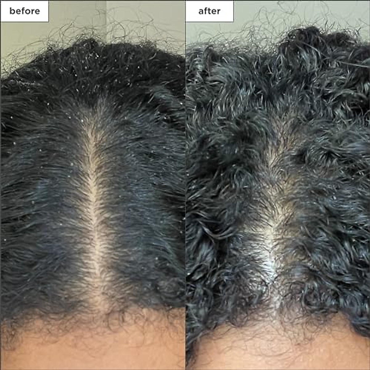 Briogeo Scalp Revival Charcoal + Coconut Oil Micro-Exfoliating Shampoo, Treatment for Dry & Itchy Scalp, Clarifying Shampoo for Build Up, Scalp Scrub for Oily Scalp, Vegan, Cruelty-Free, 8 fl oz