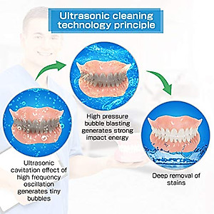 Ultrasonic Denture Cleaner, BlumWay Profession Retainer/Aligner/Mouth Guard Cleaner Machine, SUS304 Material 5 Minute Quick Cleaning