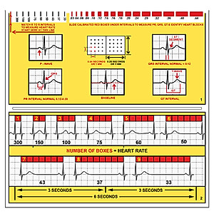 R-CAT for Arrhythmias EKG Pocket Reference Guide – Great Study Card for EKG Interpretation - ACLS and PALS Training – Cardiac Rhythm Interpretation Made Easy