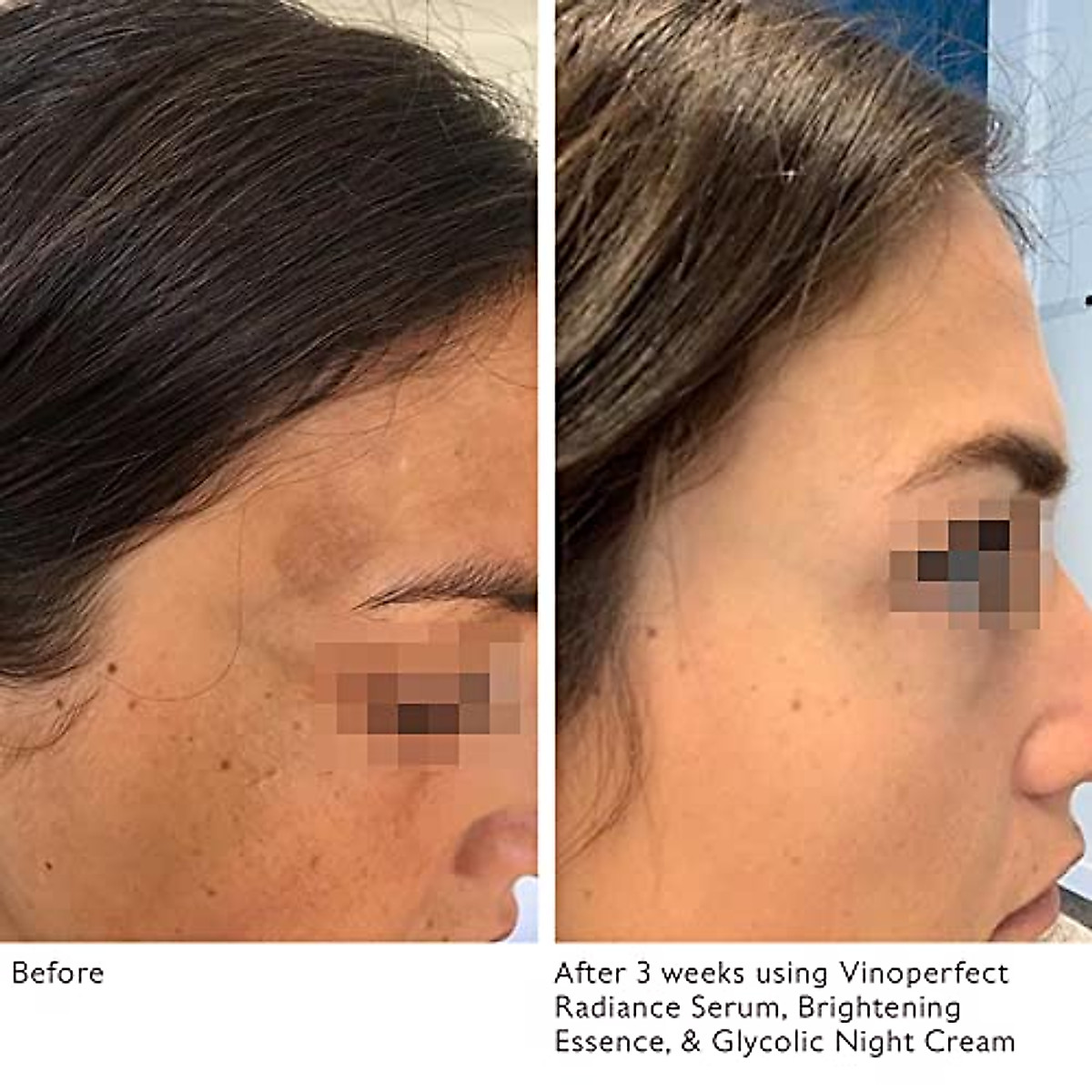 Caudalie Vinoperfect Radiance Dark Spot Serum - 62x more effective than Vitamin C (Gift Set)