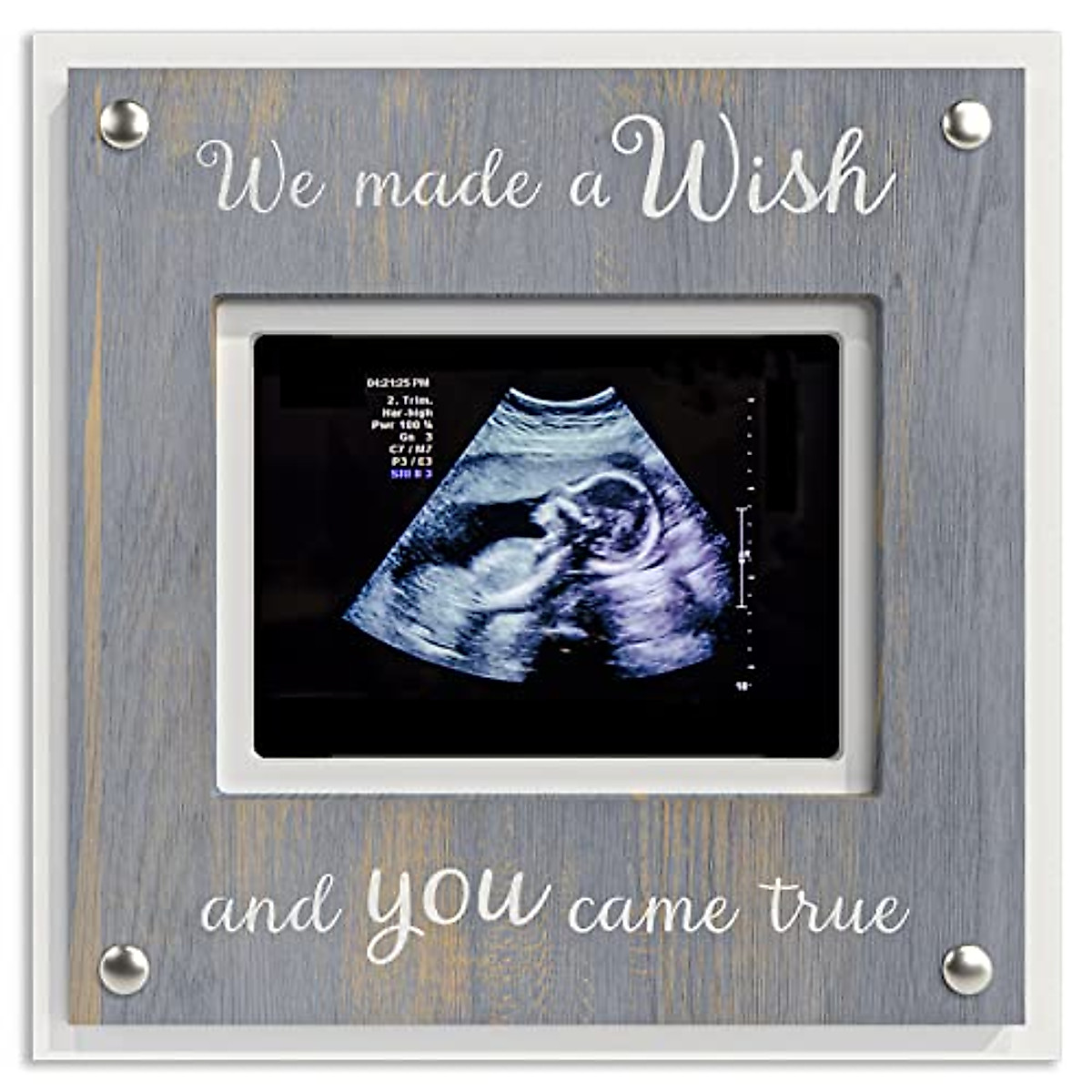 1Dino Premium Baby Sonogram Keepsake Picture Frame, Ultrasound Frame - 8.5" x 8.5" White/Grey Wood Photo Frame - Gift Idea for Expecting Parents, Baby Shower, First Time Mom/Dad Gifts, Nursery Decor