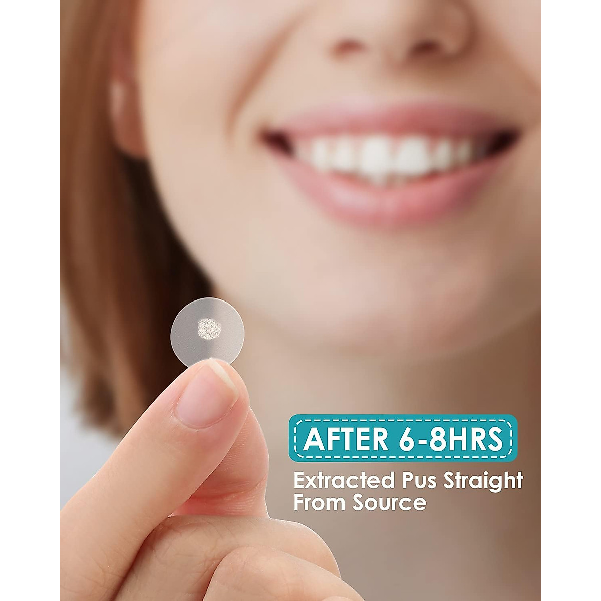 Pimple Patches for Face, Hydrocolloid Acne Patches with Tea Tree Oil for Spot Treatment, Zit Patch, Blemish Cover, Two Sizes, Vegan, Cruelty Free (144 Count (Pack of 1))