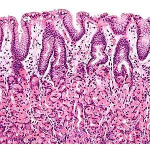 Set of 100 Microscope Prepared Typical Histology Slides for Medical Study Education Teaching