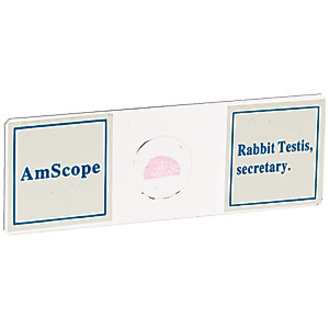 AmScope PS50A Prepared Microscope Slide Set for Basic Biological Science Education, 50 Biology and Pathology Slides, Includes Fitted Wooden Case