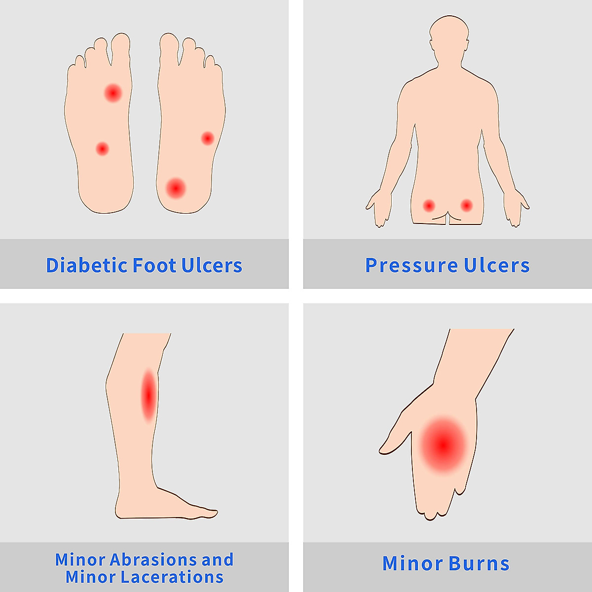 Algitocare Calcium Alginate Wound Dressing 4"x4" with 2"x2"