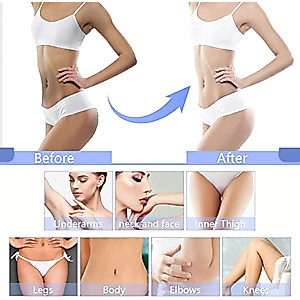 Intimate Area Dark Spot Remover Corrector For Body, Underarms, Armpit, Knees, Elbows, and inner Thigh All-Natural Designed by USA