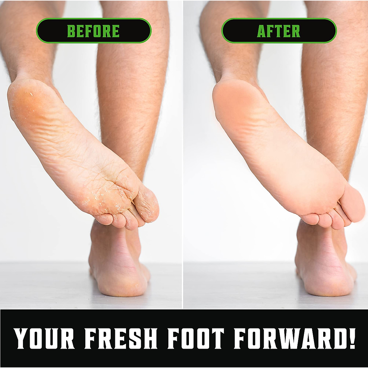 Viking Revolution Skin Cleaning Agent Tea Tree Kit for Men - Tea Tree Oil Set with Body Wash & Balm - Hydrating, Helps Athlete's Foot, Jock Itch, Eczema & Body Odors - Extra Strength, 2 Piece Set