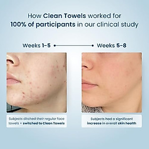 Clean Skin Club Clean Towels, 100% USDA Biobased Dermatologist Approved Face Towel, Disposable Clinically Tested Face Towelette, Facial Washcloth, Makeup Remover Dry Wipes, Ultra Soft, 100 ct, 4 pack