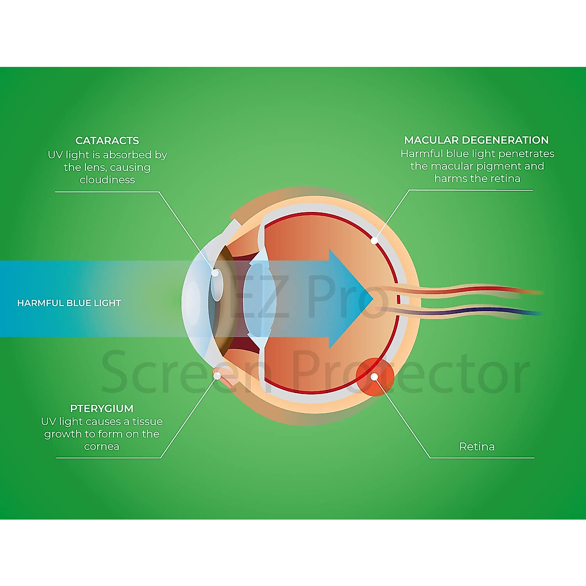 Premium Anti Blue Light and Anti Glare Screen Protector (2 Pack) for 20 inches (Measured Diagonally) Monitor. Screen Protector Size is 17.4" Width x 9.8" Height. Easy and Bubble Free Installation