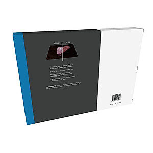 Duck Retail Defrosting Tray | Thawing Plate for Fast defrosting of Frozen Foods | Premium Quality Defrost Tray | with Bonus Drip Tray| Extra Thick (4mm) Non-Stick