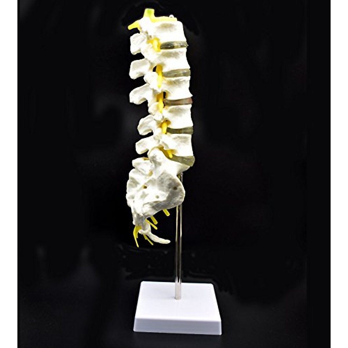 Medical Human Lumbar Spine Demonstration Model Anatomical Model Lumbar Vertebrae Sacrum & Coccyx, with Herniation Disc,for Science Classroom Study Display Teaching Medical Model 15 Inch Hight