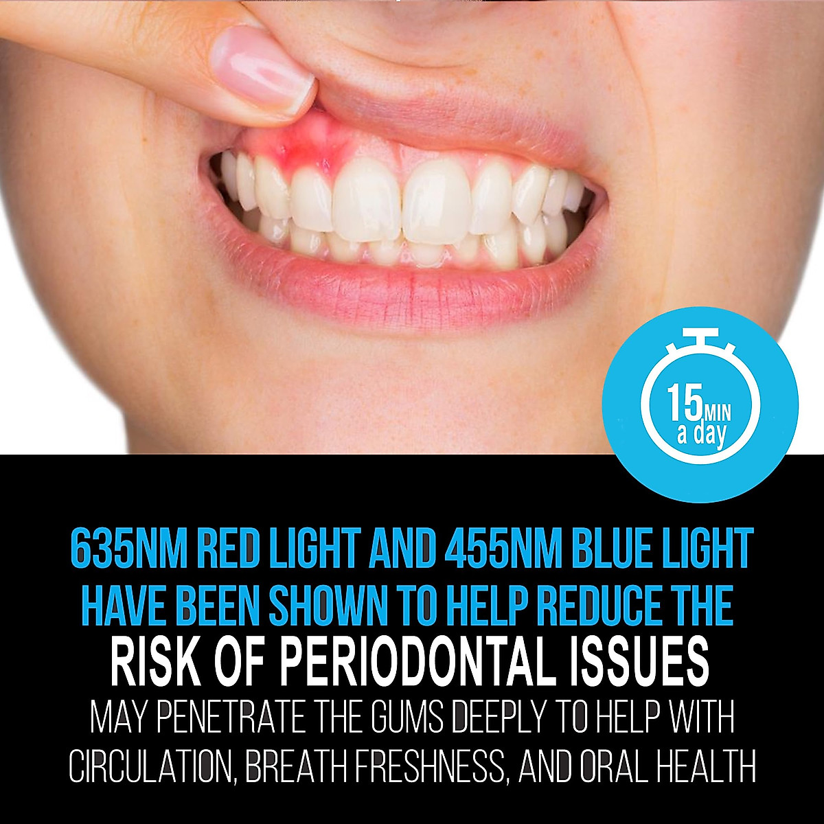 Starlite Smile Blue Light Red Light Gum Light, Periodontal Light, Oral Care, Blue Light Teeth Whitening Accelerator Light