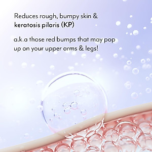 Bliss Body Butter Texture Takedown Skin Smoothing Lotion - Keratosis Pilaris KP - 6.7 Fl Oz - For Rough, Bumpy Skin - 10% AHA + Squalane + Shea Butter - Clean - Vegan & Cruelty-Free