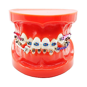 Dental Typodont With Metal Brackets Orthodontic Teeth Model With Ligature Ties Red