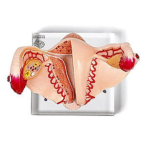 Human Uterus Ovary Urinary Bladder Model On Plexiglass Base, Female Reproductive Organ Model, Female Genital Organ, Shows Uterus, Ovary, Vagina, Uterine Medical Teaching Anatomical Gynecology