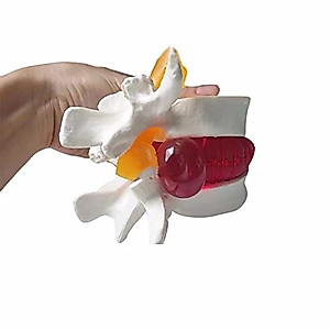BoNew-Oral 1:1.5 Anatomical Human Lumbar Vertebrae Degenerative Lumbar Human Spine Model White Color