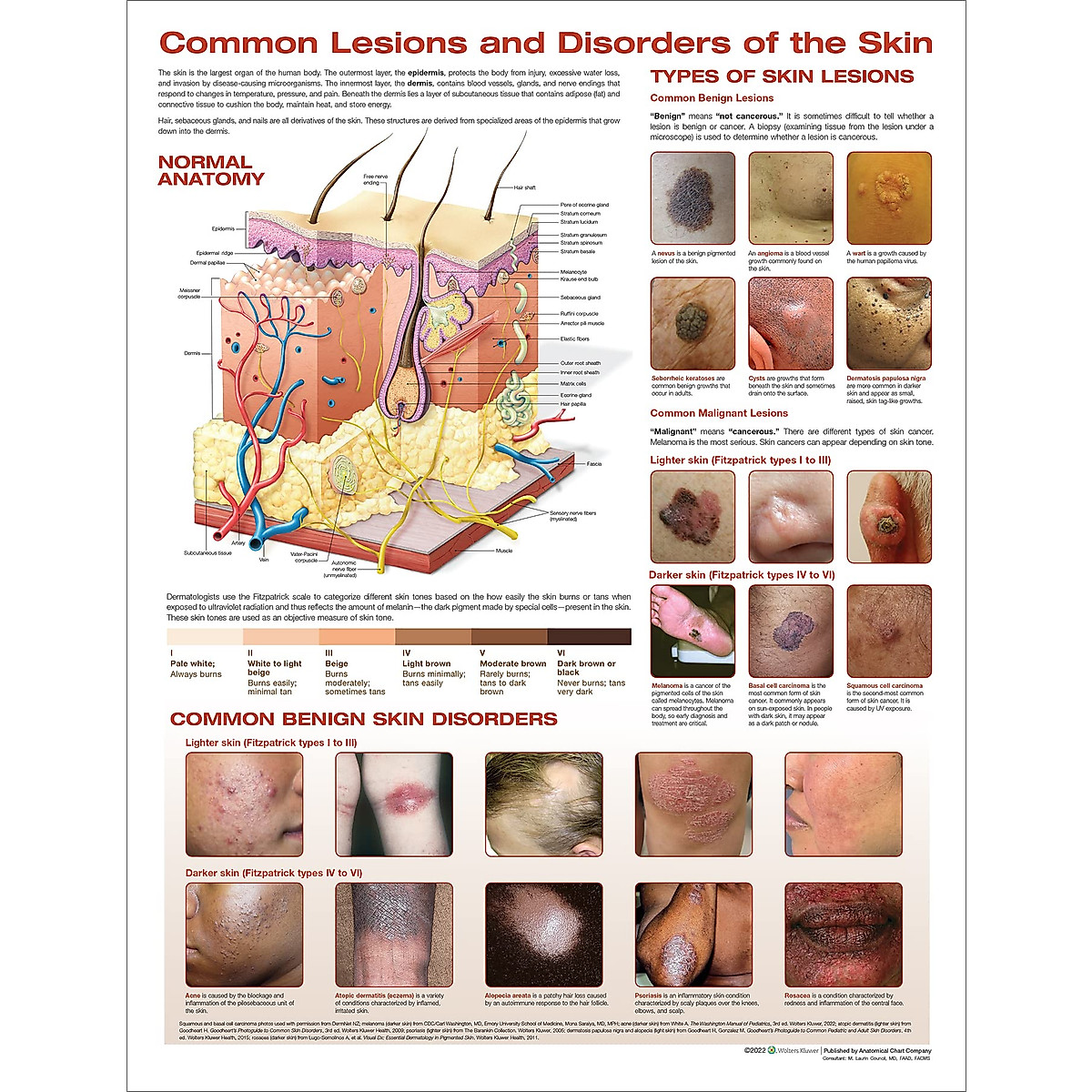 The Skin and Common Disorders Anatomical Chart