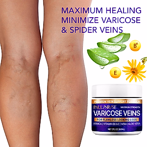 PAULINRISE Varicose Vein Cream for Legs - Improves Blood Circulation, Reduces Spider Veins and Heaviness, 2 Oz