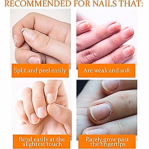 Nail Tek Repairs Damaged Nails kit.Intensive Therapy(.5OZ),Foundation(.5OZ)& Renew(.48OZ)