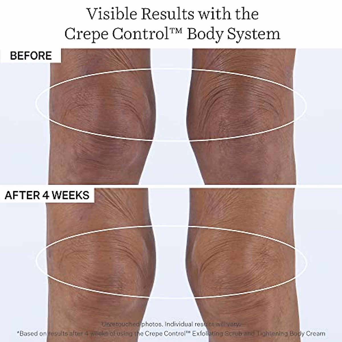 StriVectin Tighten & Lift Crepe Control Exfoliating Body Scrub, Targets Crepiness and Rough, Dull Skin, 5 Fl Oz, white