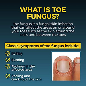 Fungi-Nail Anti-Fungal Liquid Solution, Kills Fungus That Can Lead to Nail & Athlete's Foot with Tolnaftate & Clinically Proven to Cure and Prevent Fungal Infections 1 Fl Oz (Pack of 1)