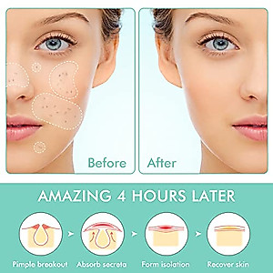 Mandabloom Acne Pimple Patches, 6 Sizes 104 Patches for Large Zit Breakouts, Acne Patches for Face, Chin or Body, Hydrocolloid Bandages Acne Treatment with Tea Tree & Calendula Oil & Salicylic Acid