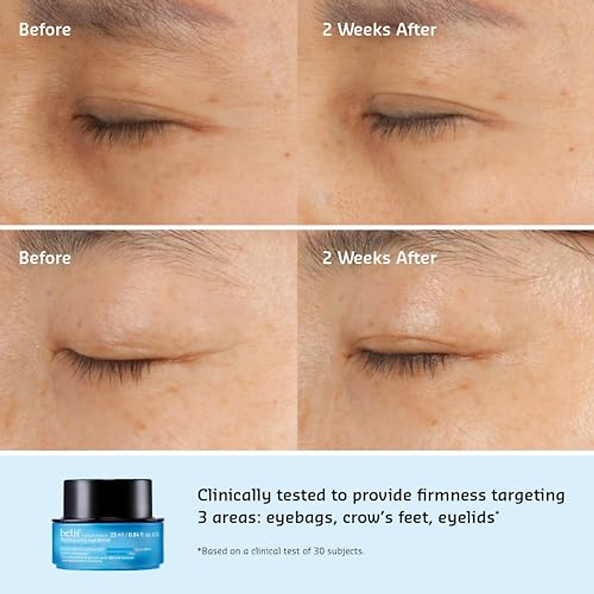 belif Moisturizing Eye Bomb Cream with Squalane, 26 hrs of Moisture, Boosts Elasticity, Increases Skin Resilience, Good for Dryness & Loss of Firmness, For Normal, Dry, Combination, Oily Skin Type